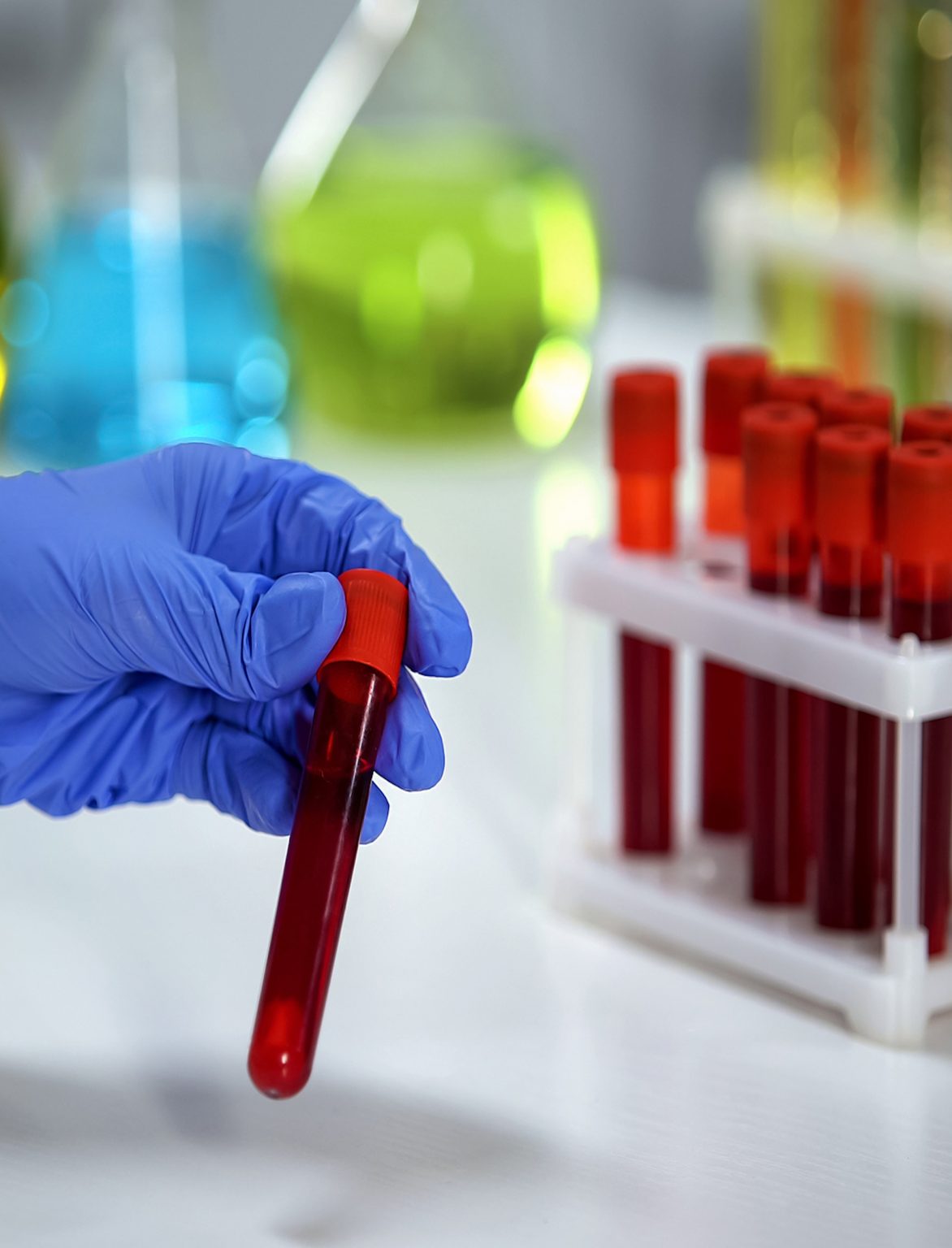 Blood Laboratory - DrQuinonez